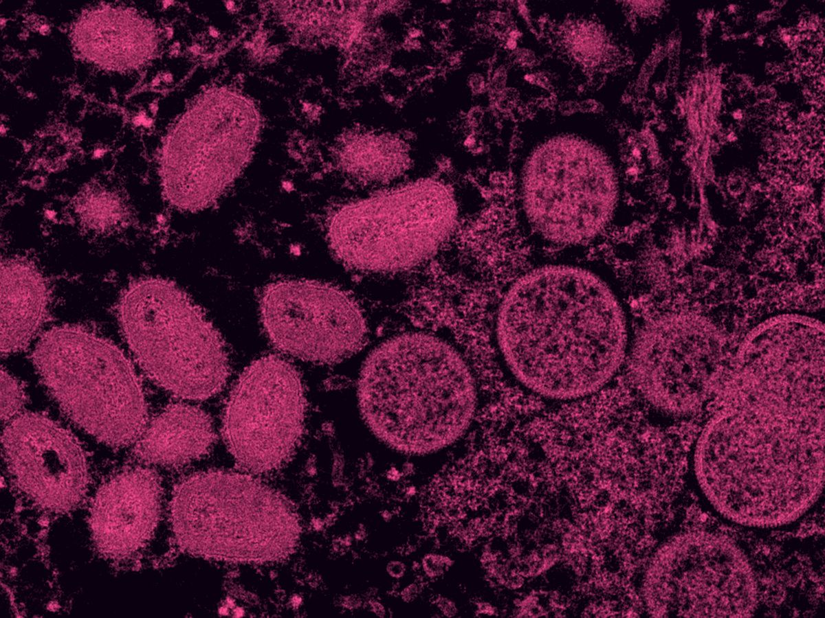 Mpox / variole du singe : un cluster et des recommandations toujours d ...